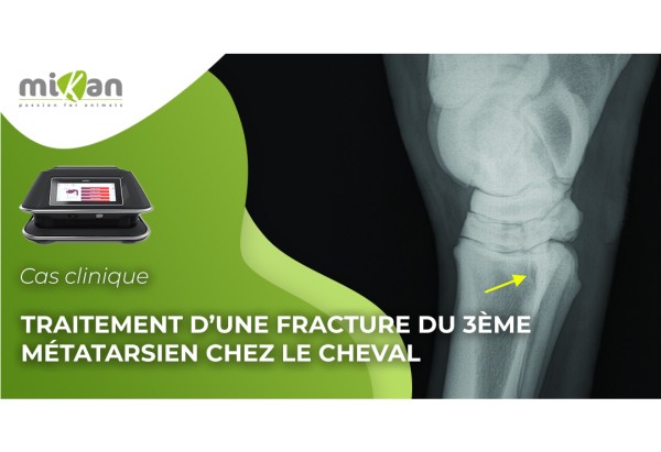 La radiofréquence : un outil efficace dans la récupération des ...